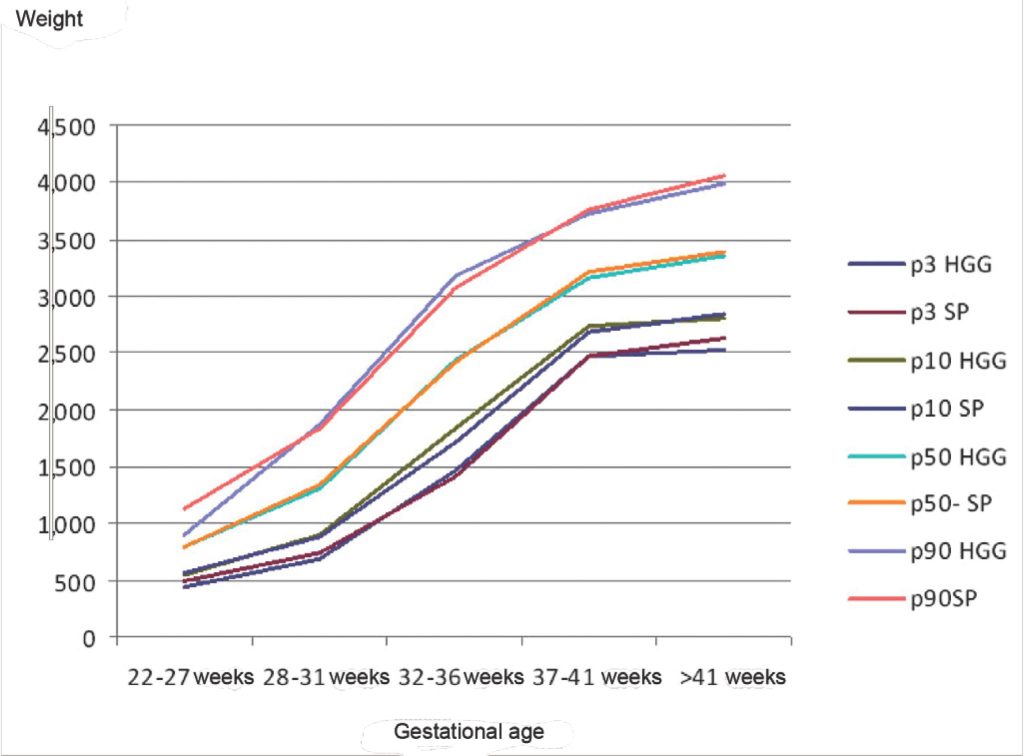 Birth weight distribution of Hospital Geral do Grajaú population ...