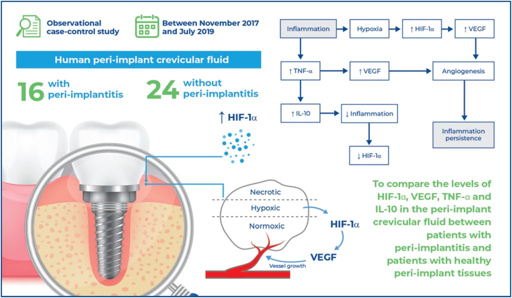 New immunological aspects of peri-implantitis - einstein (São Paulo)
