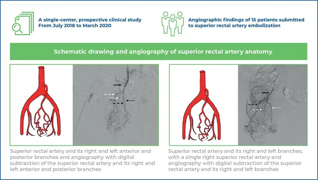 Angiographic description of the superior rectal artery and its ...