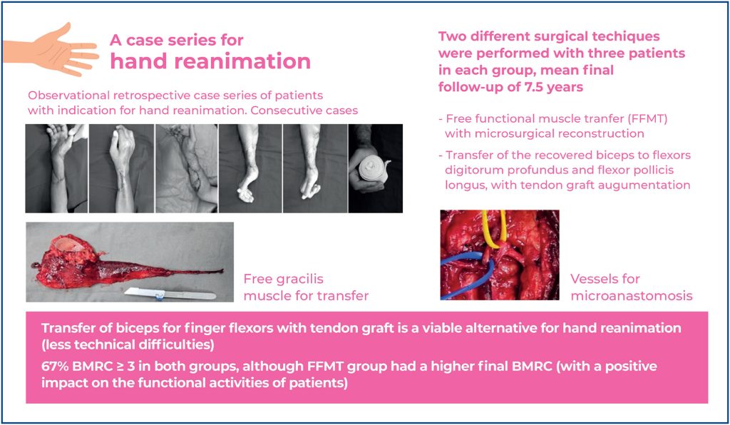 Hand reanimation: functional free gracilis transfer or transfer of the ...